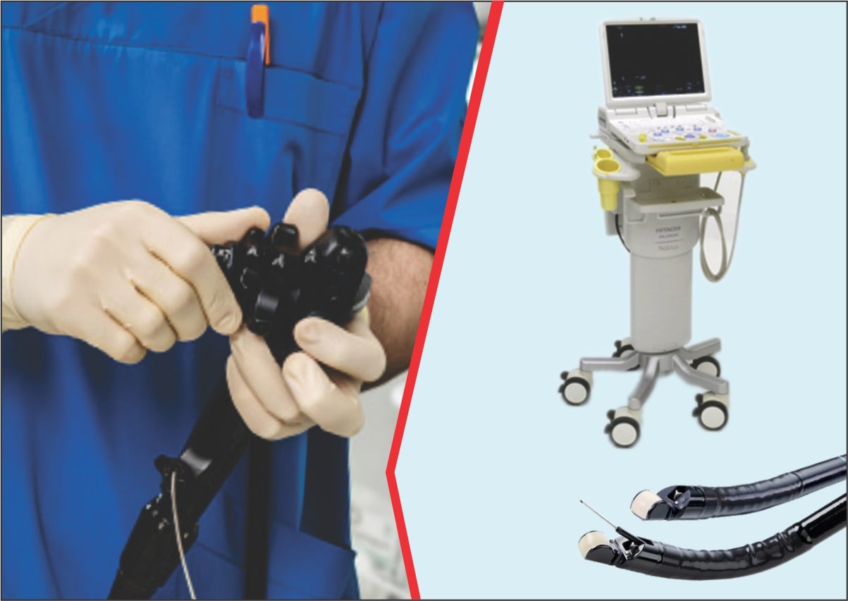 Endoscopic Ultrasound (EUS) | Shifa International Hospitals Limited